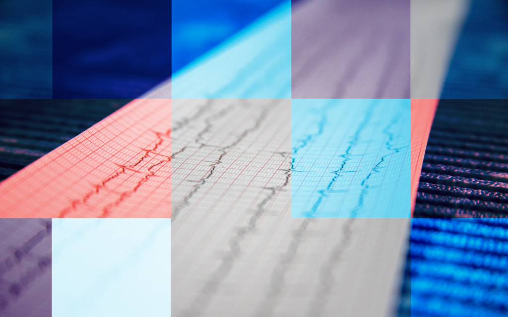 Integrated ECG Risks Patient Data Loss - Health IT